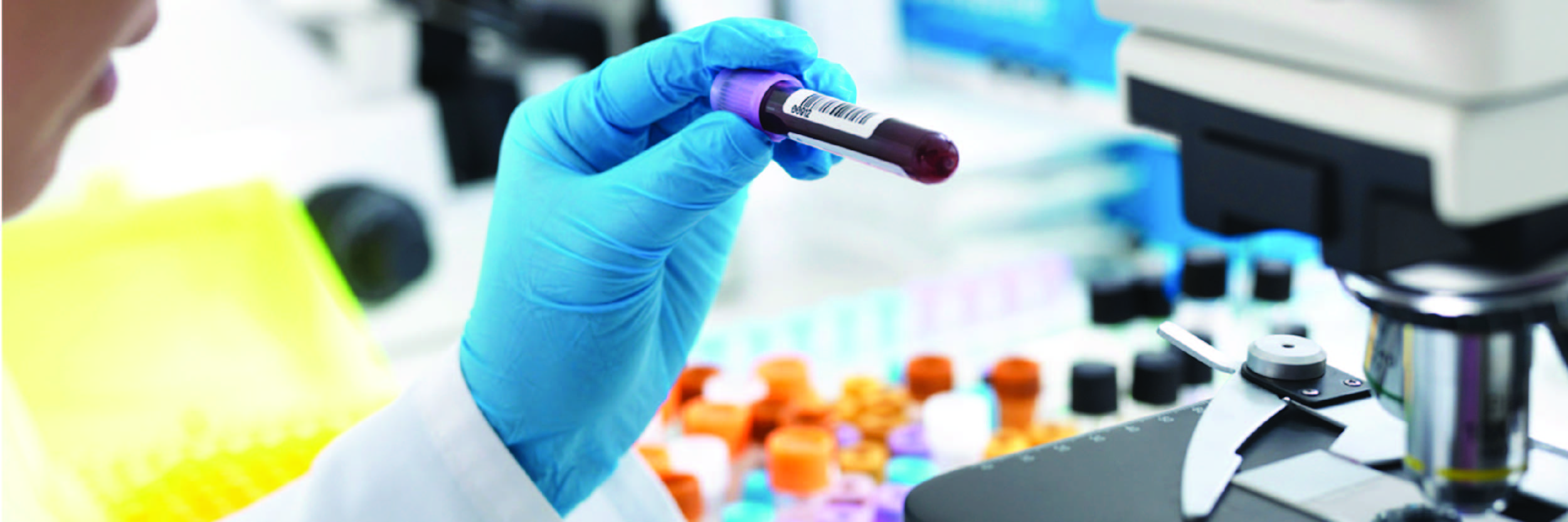 The hormone lab – The Hormone lab & infertility center